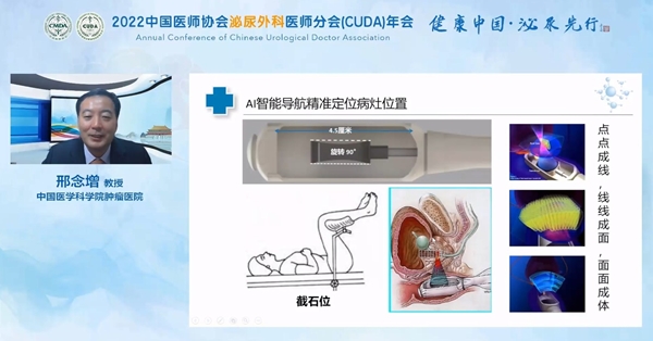天士力医药- 新闻动态 - 集团新闻 -2022 CUDA泌尿年会盛大召开，Sonablate引领机器人板块， 聚焦无创局灶治疗